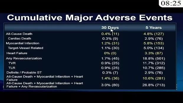OCC2019丨徐波：改善CTO PCI效果，适应证比技术更重要__凤凰网