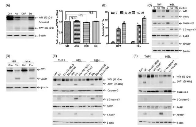 温州医科大学附二医院发现白血病人中WT1基因的调控新机制__凤凰网
