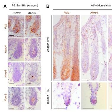 应用RNAscope®进行测序后验证-中国研究团队文章解读_凤凰网健康_凤凰网