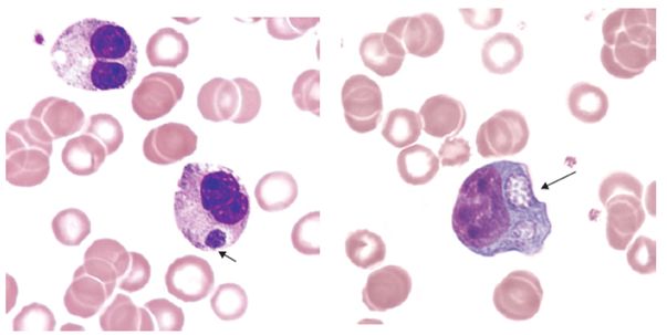 检验传奇之美国病人__凤凰网