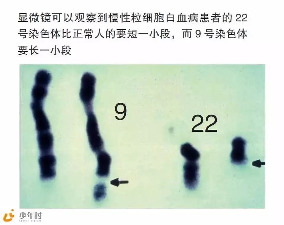 费城染色体是如何形成的？__凤凰网