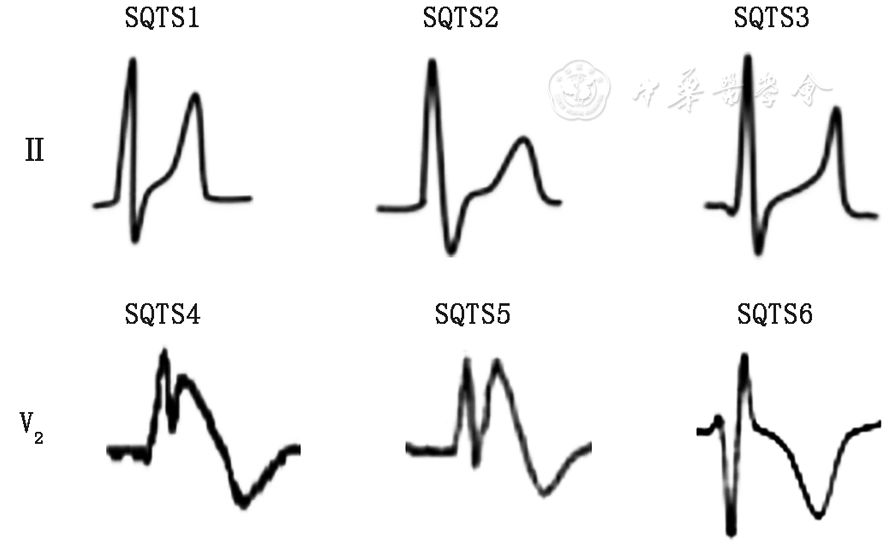 遗传性短QT综合征的研究进展__凤凰网