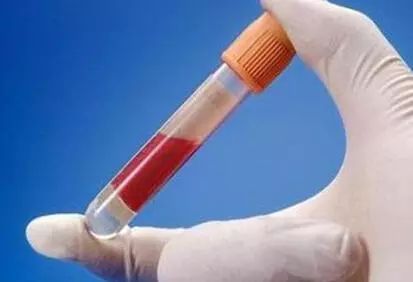 #读科普#INR到底是什么东东？__凤凰网