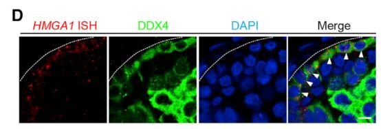 应用RNAscope®进行测序后验证-中国研究团队文章解读_凤凰网健康_凤凰网